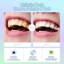 BUY 1 TAKE 1 | SCOBAN Teeth Whitening Soda Toothpaste & Teeth Whitenin ...